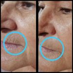 Before and after photos - Brightcore Revive Collagen - HBN Show