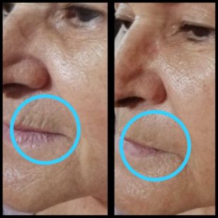 Before and after photos - Brightcore Revive Collagen - HBN Show