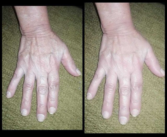 Before and after photos - Brightcore Revive Collagen - HBN Show